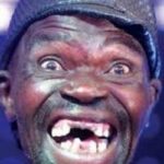 Ugliest People in the World in 2023? (See Top 12 Persons Now)